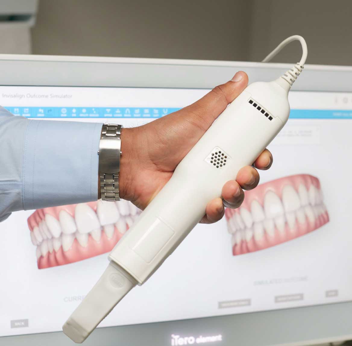 Alignement dentaire pour adultes | Invisalign