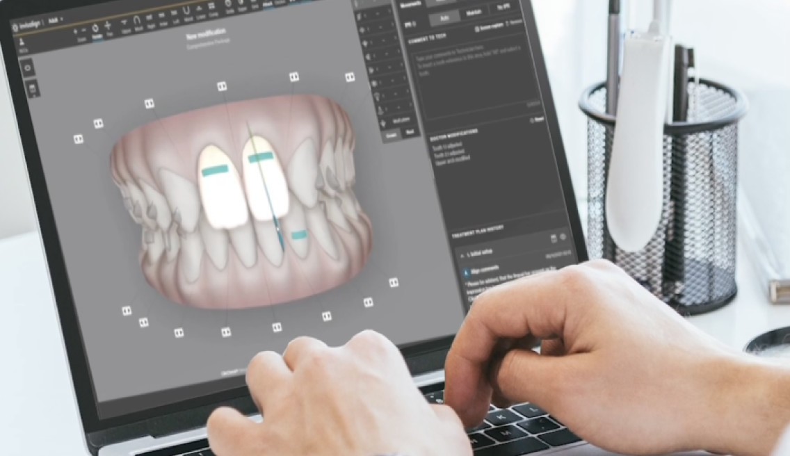 3D Controls | Invisalign Provider