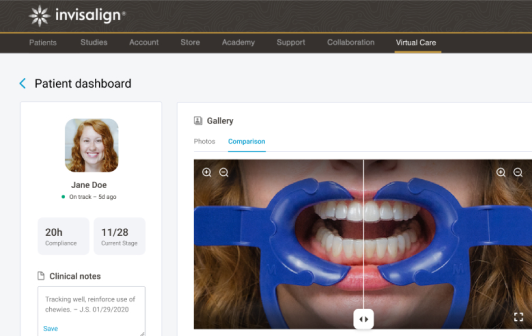 Virtual Appointments | Invisalign Provider