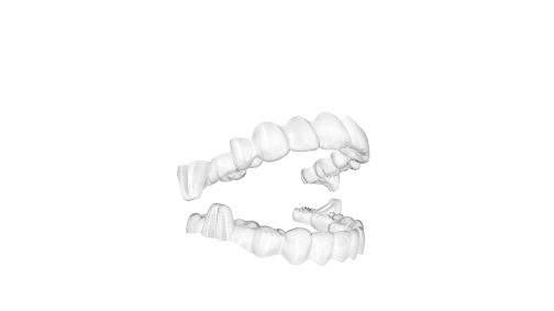 Mandibular Advancement | Invisalign Provider
