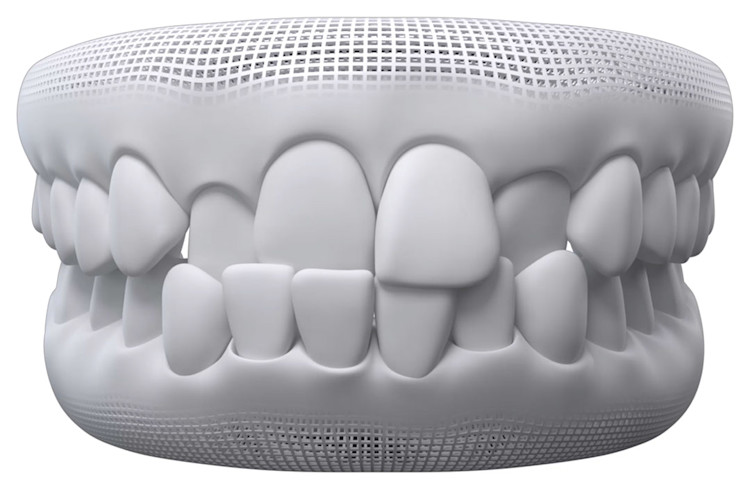 What is a crossbite and how to fix it | Invisalign