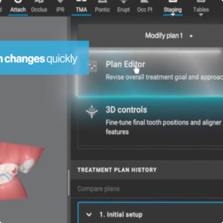 ClinCheck | Invisalign Provider