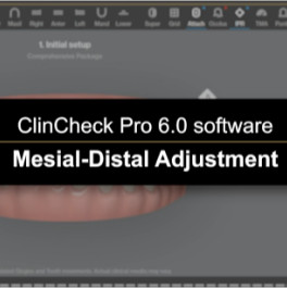 3D Controls | Invisalign Provider
