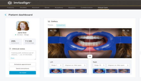 Virtual Solutions | Invisalign Provider