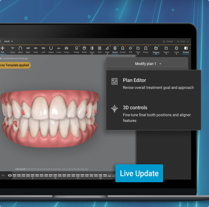 ClinCheck Plan Editor | Invisalign Provider