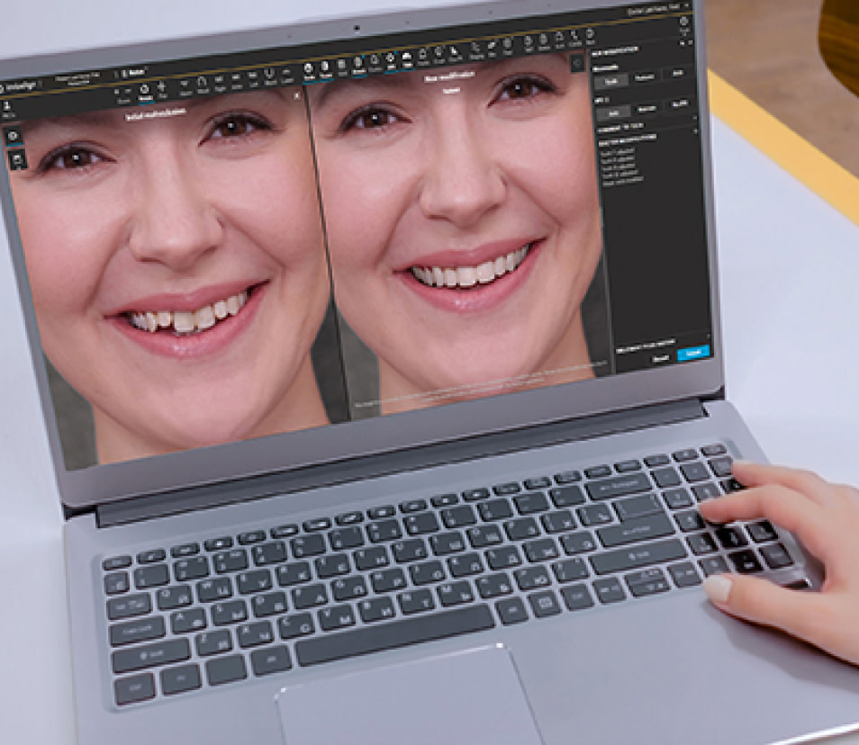 Benefits of a Dental Digital Practice - Going Digital | Invisalign Provider