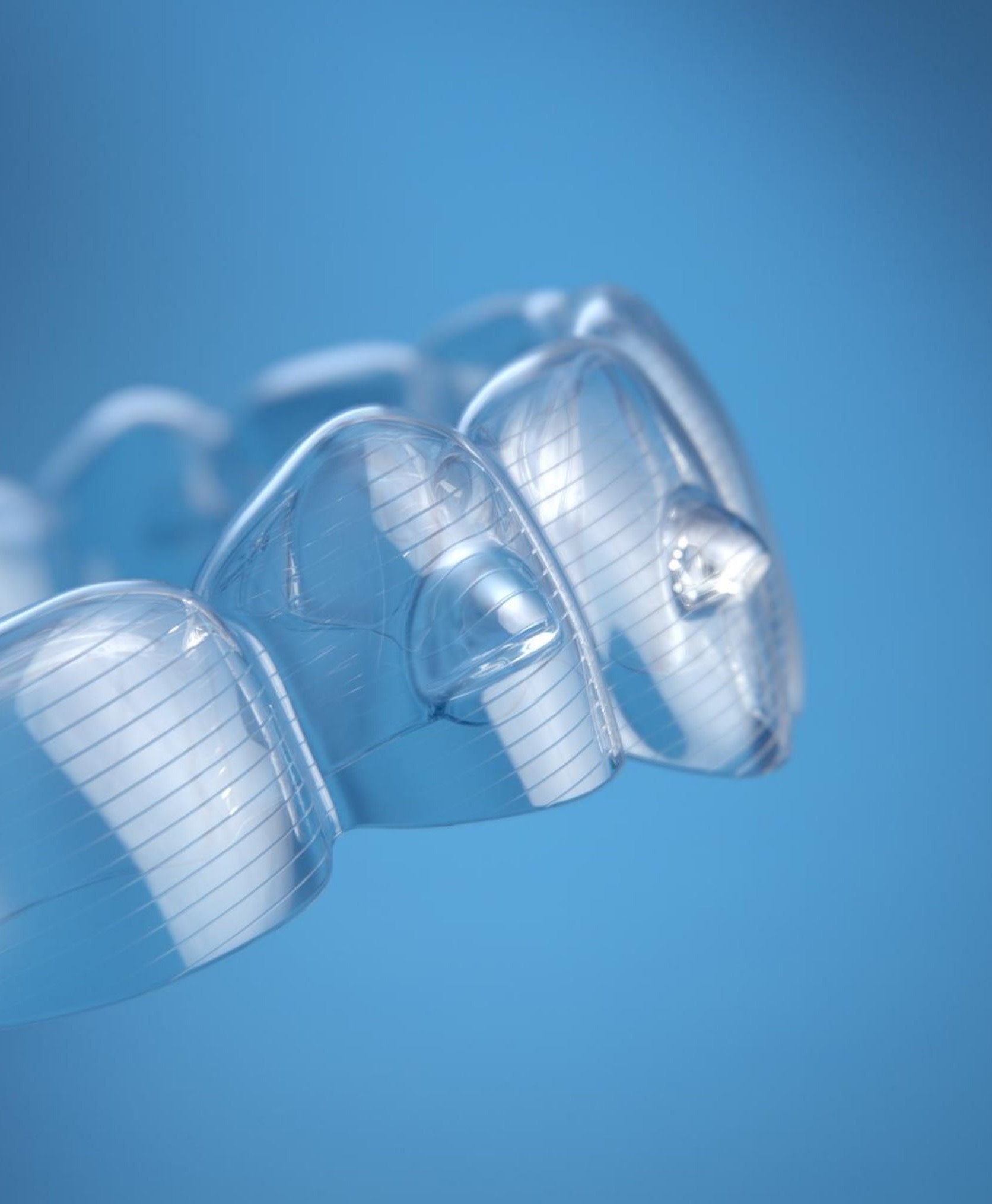 Aspectos diferenciadores del sistema Invisalign | Invisalign Provider