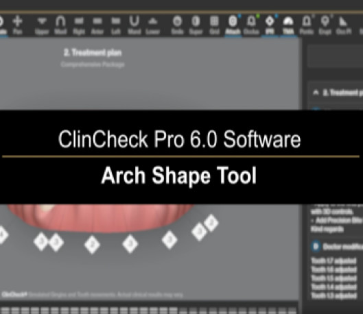 3D Controls | Invisalign Provider