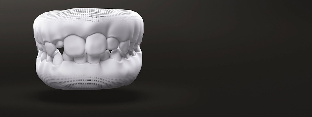 Hoidettavat tapaukset