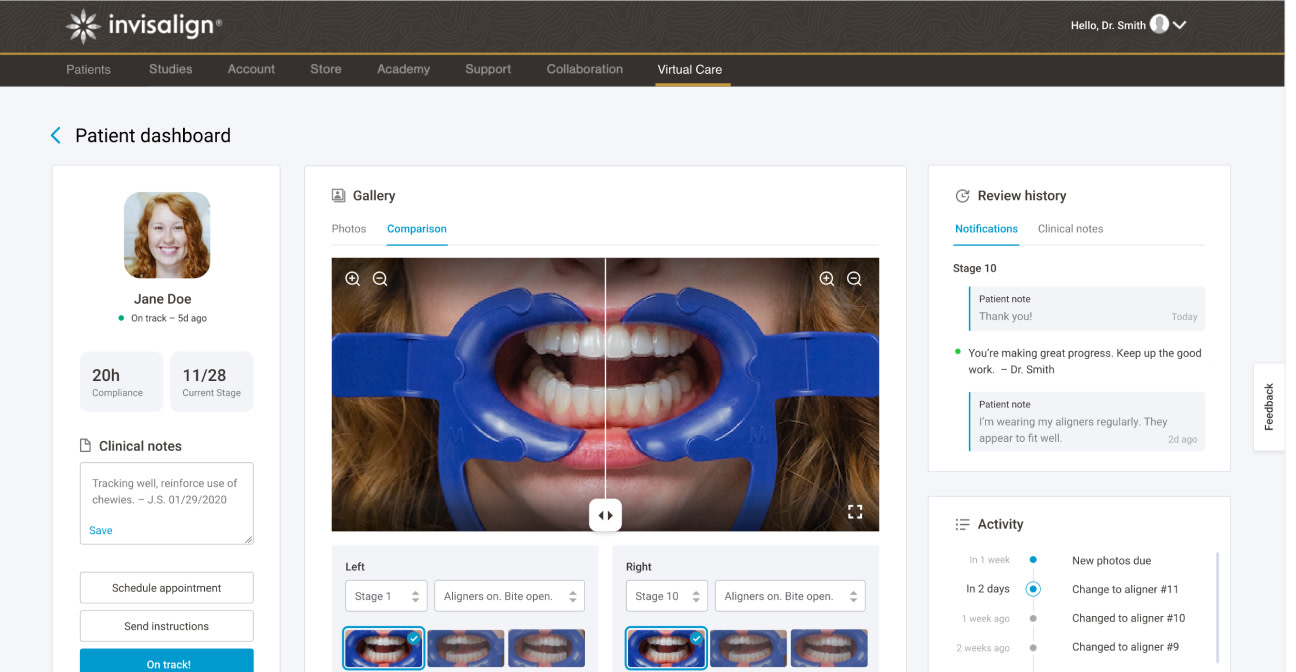 Virtual Appointments | Invisalign Provider