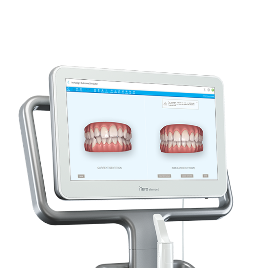 Virtual Solutions | Invisalign Provider