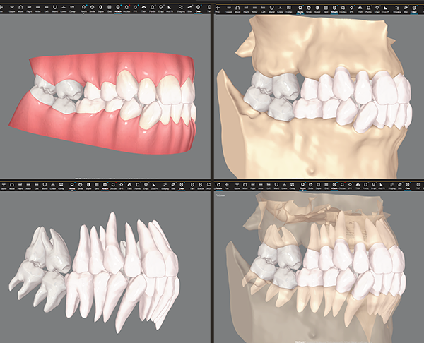 ClinCheck 6.0