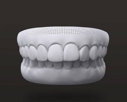 Benefits of a Dental Digital Practice - Going Digital | Invisalign Provider