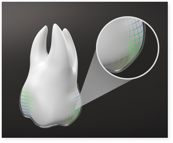 Invisalign Treatment System | Invisalign Provider