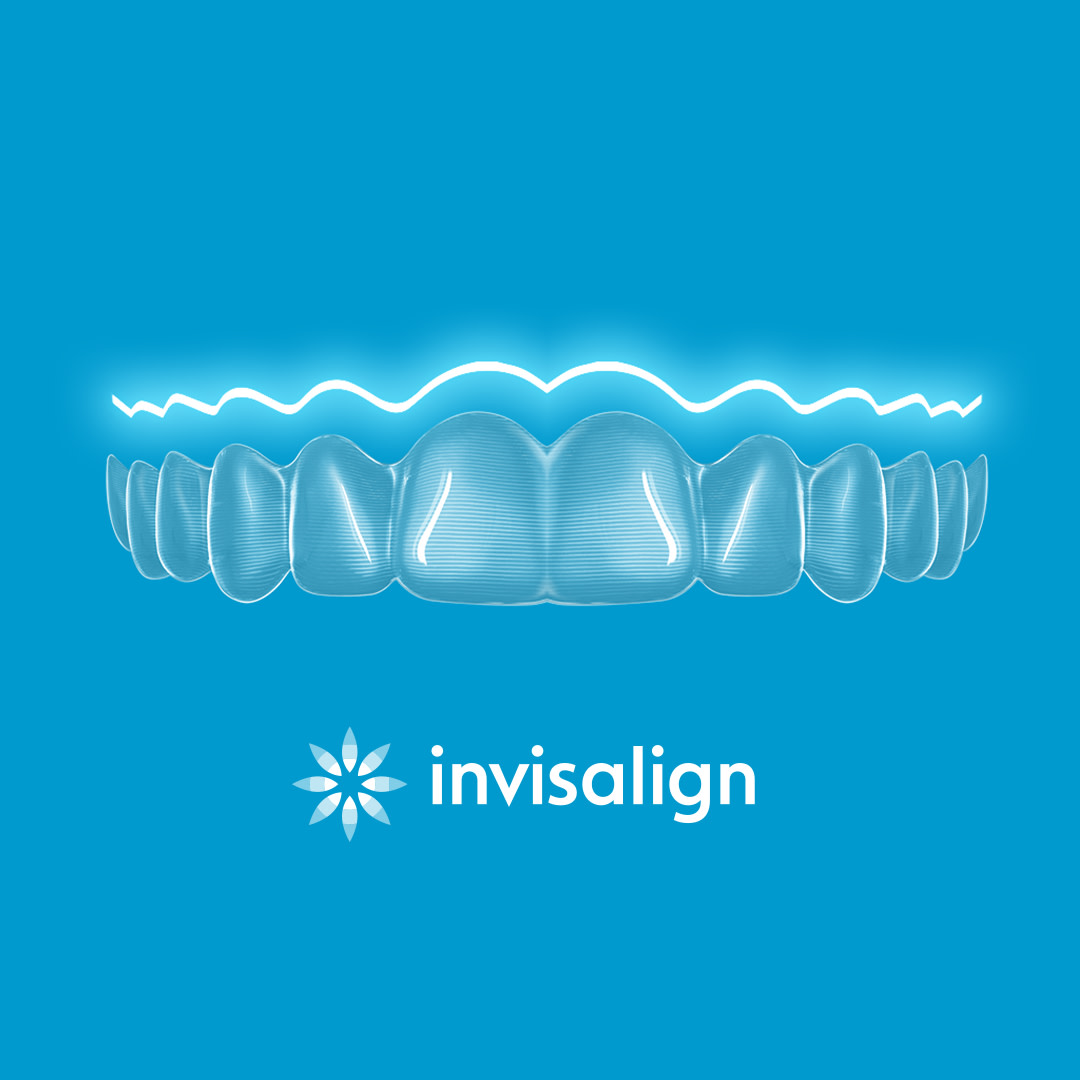 Straighten teeth| Invisible aligners | Invisalign Treatment | Vivera ...