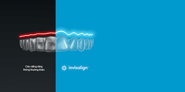 Invisalign | Khay niềng răng trong suốt Invisalign