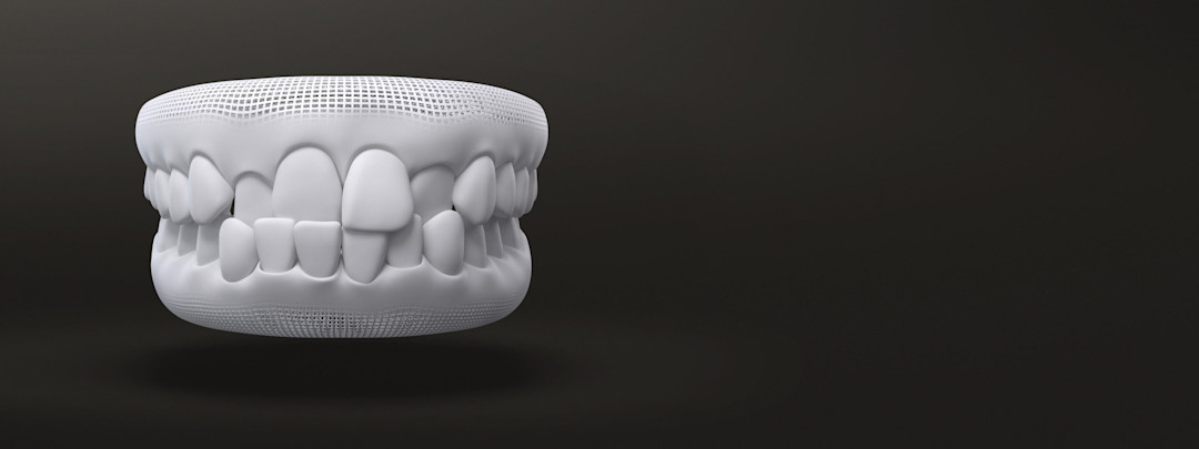 How Long Is The Invisalign Treatment Process | Invisalign aligners