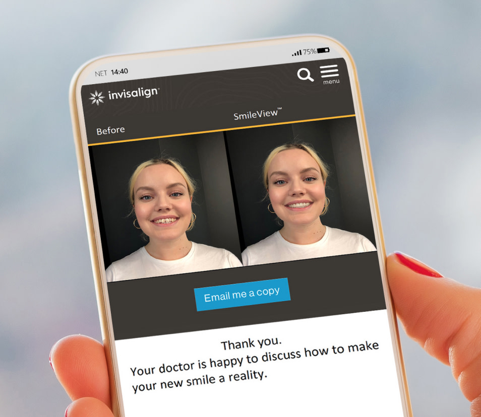 Benefits of a Dental Digital Practice - Going Digital | Invisalign Provider