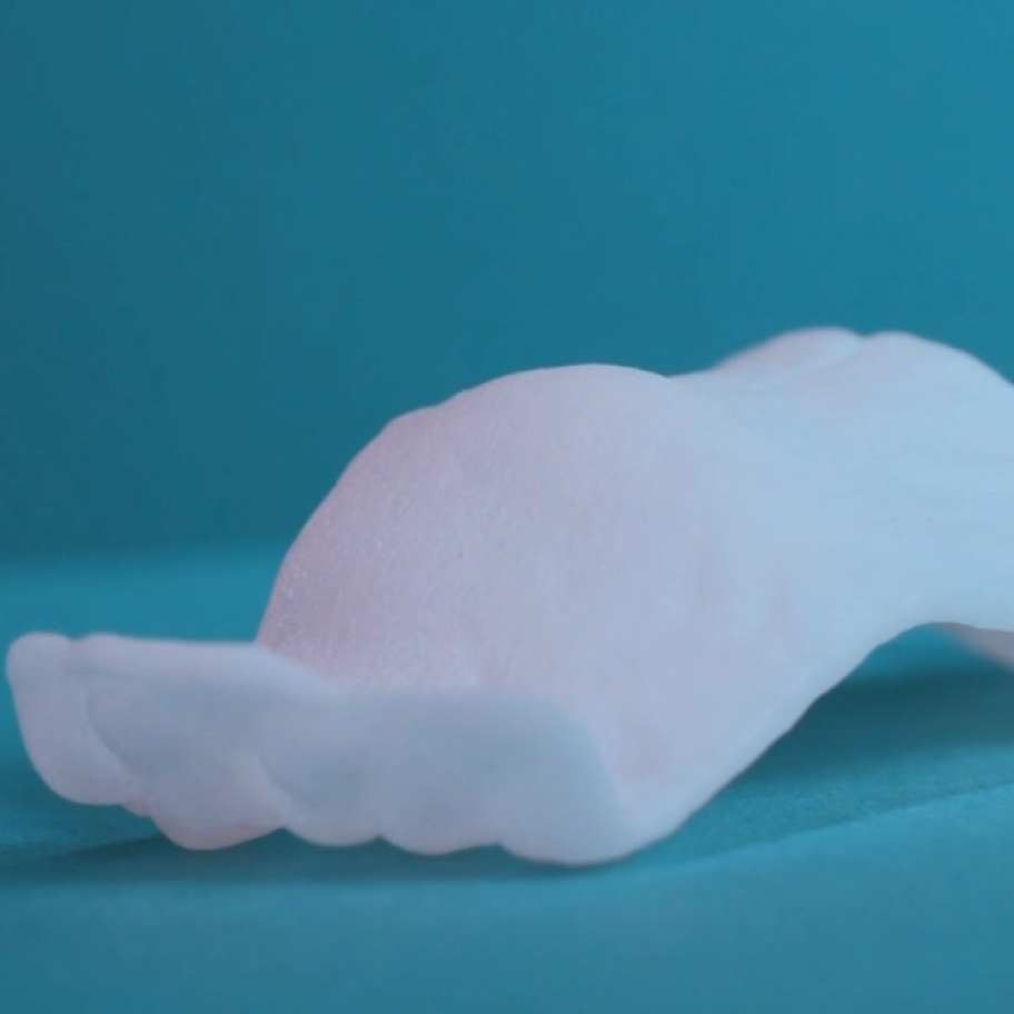 Invisalign Palatal Expander | Invisalign