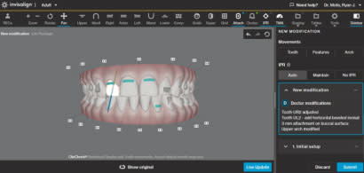 ClinCheck 6.0