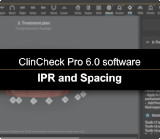3D Controls | Invisalign Provider