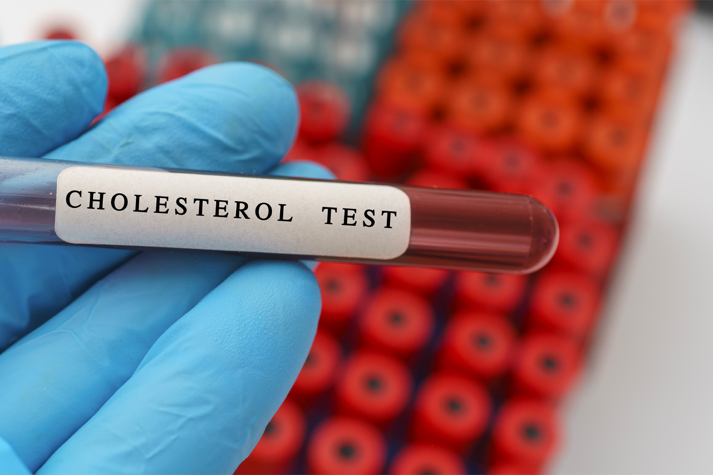 Lowering LDL-C Is the First Step