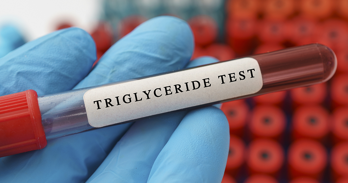 What Are Triglycerides?