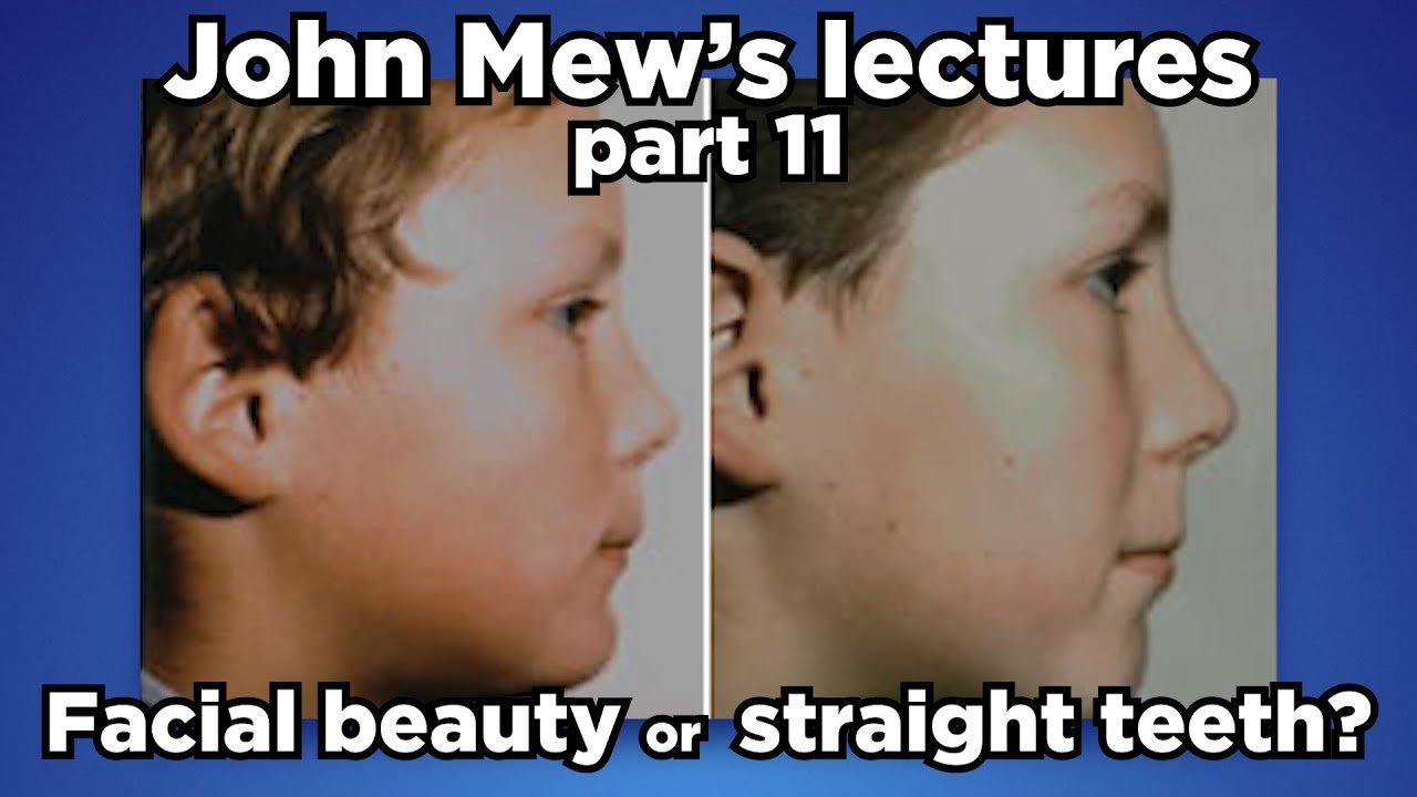 John Mew’s Lecture Part 11 – Changing Facial Aesthetics - Orthotropics