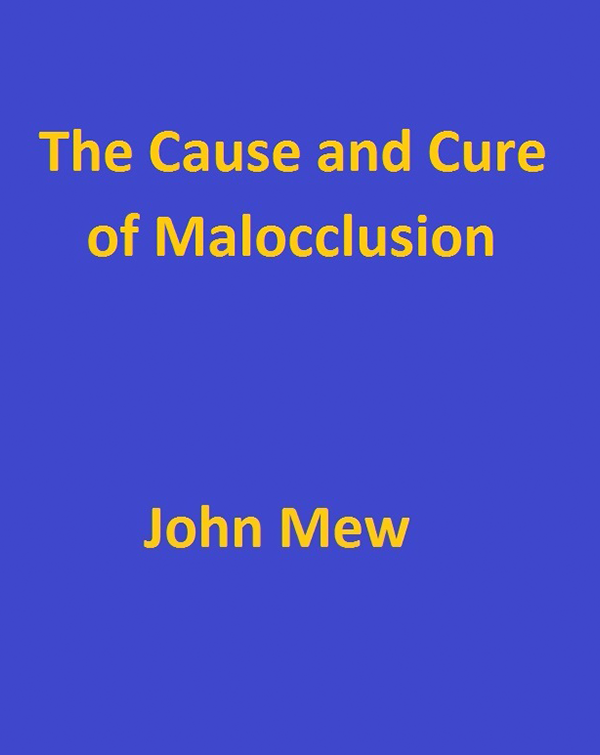 The Cause and Cure of Malocclusion by Prof. John Mew (Revised edition ...