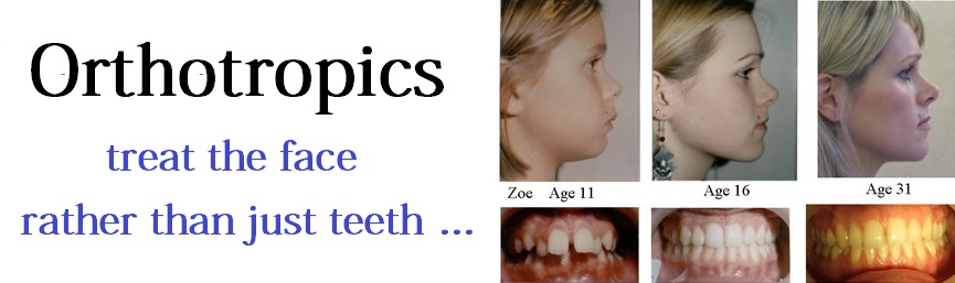 Orthotropics- Thinking Beyond the Teeth - Orthotropics