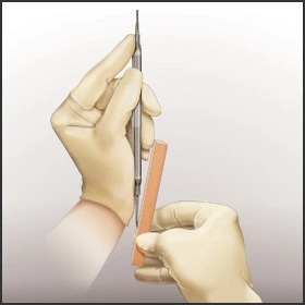 Sharpening Periodontal Instruments
