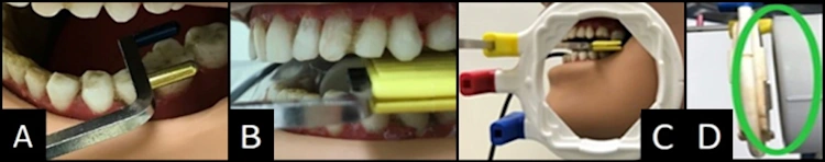 Horizontal Angulation: I am using a rod and ring aiming system. How do ...