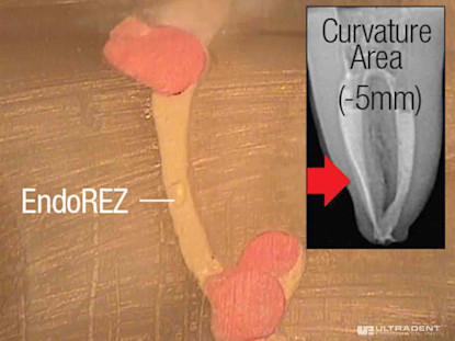 EndoREZ™ - Products - Category - Ultradent Products, Inc.