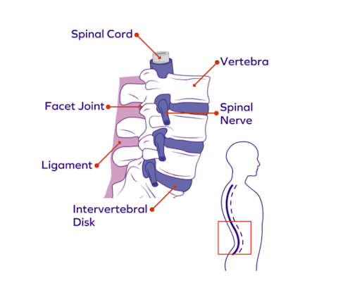 5 Exercises for Back Pain Related to a Herniated Disc | Goodpath