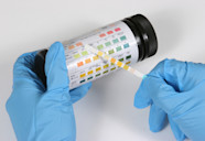 Ketones In Urine Causes And Tests Ketones In Urine Causes And Tests