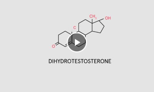 How Does Finasteride 1mg Work to Treat Hair Loss?