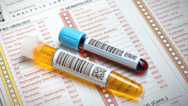 Common drugs that can interfere with lab tests | MDLinx