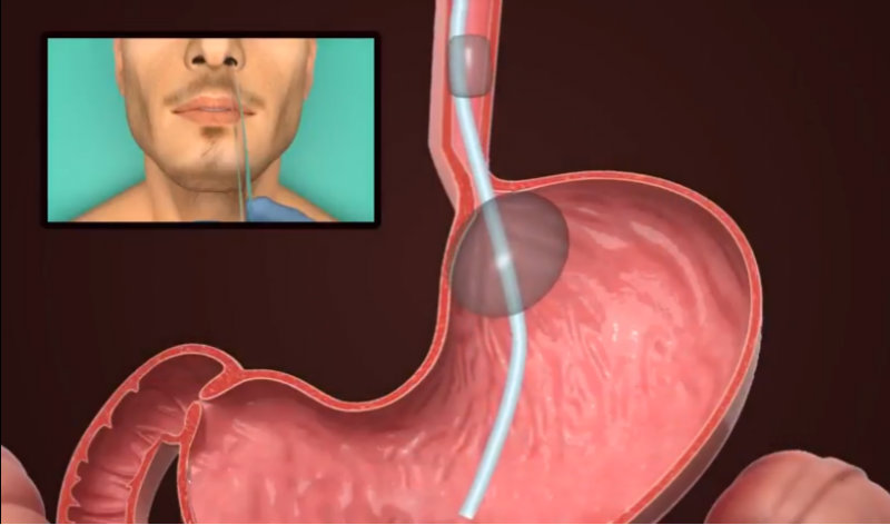 What’s next in the GI technology pipeline? | MDLinx