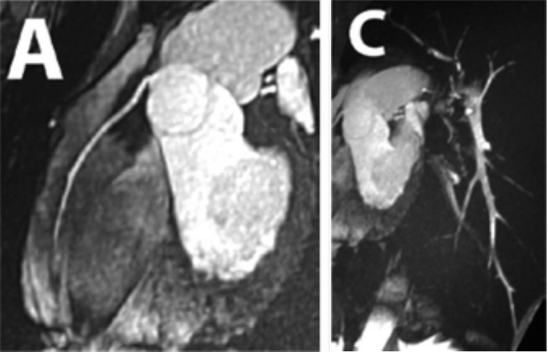 High-resolution cardiac MRI? Don't hold your breath--literally | MDLinx
