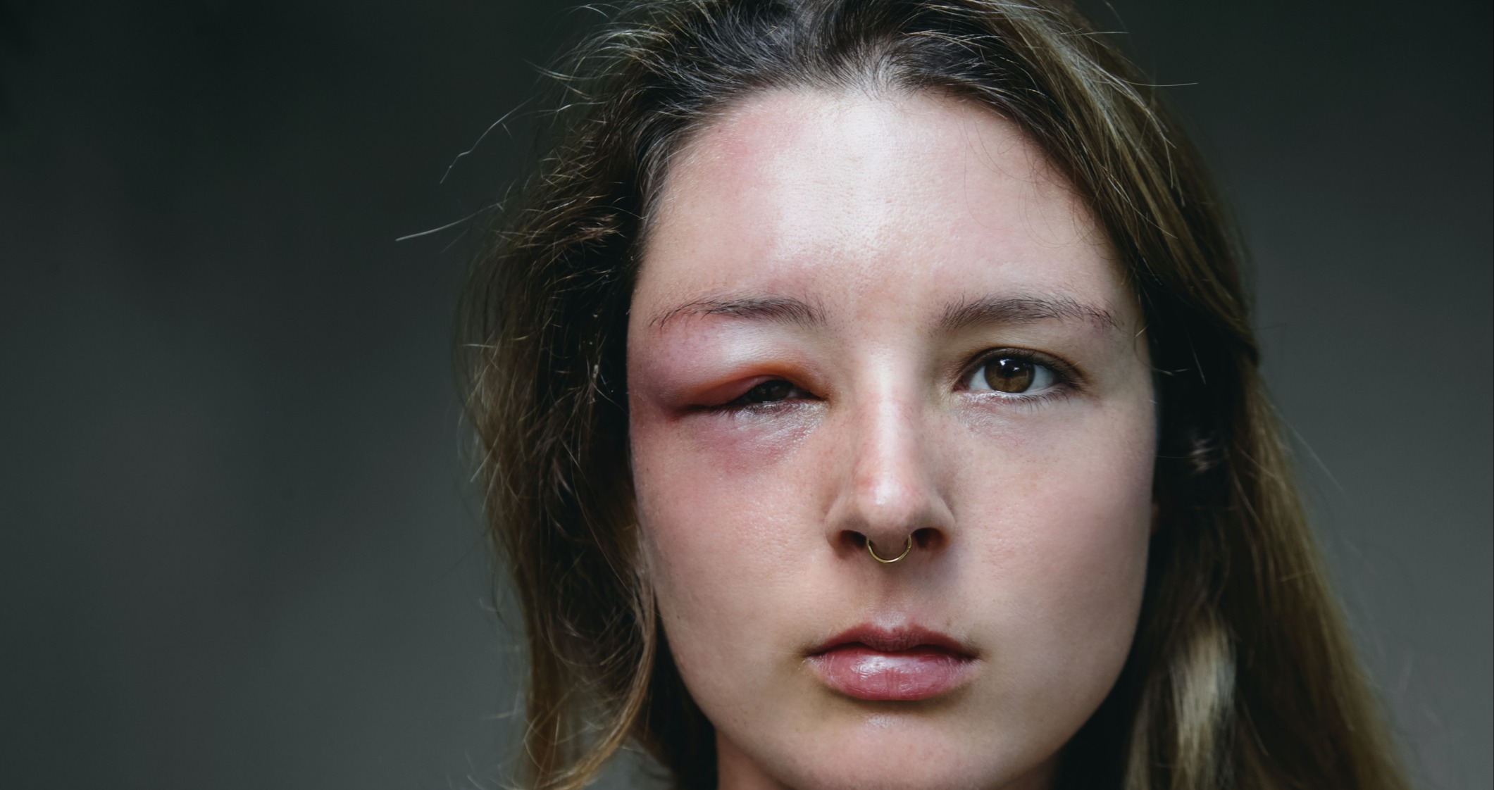 Young patients are smashing bones in their faces with hammers. Here's ...