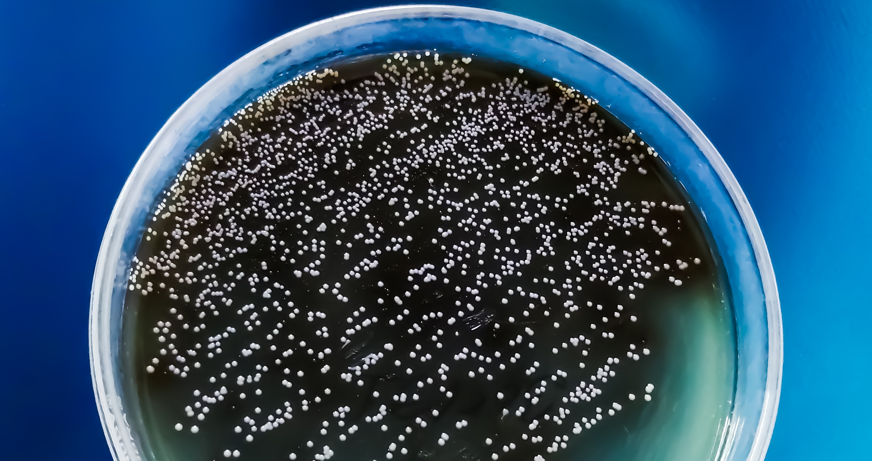 A fungal outbreak in Michigan has caused one death and over 100 ...