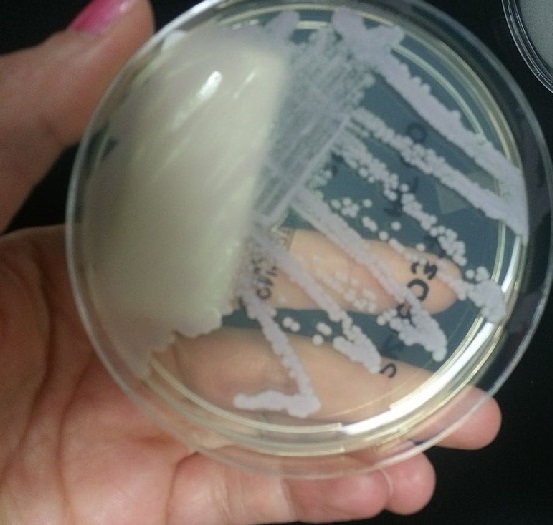 Groundbreaking research finds fungus plays a central role in Crohn's ...