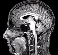 Unraveling incel complex: Is your patient an 'involuntary celibate ...