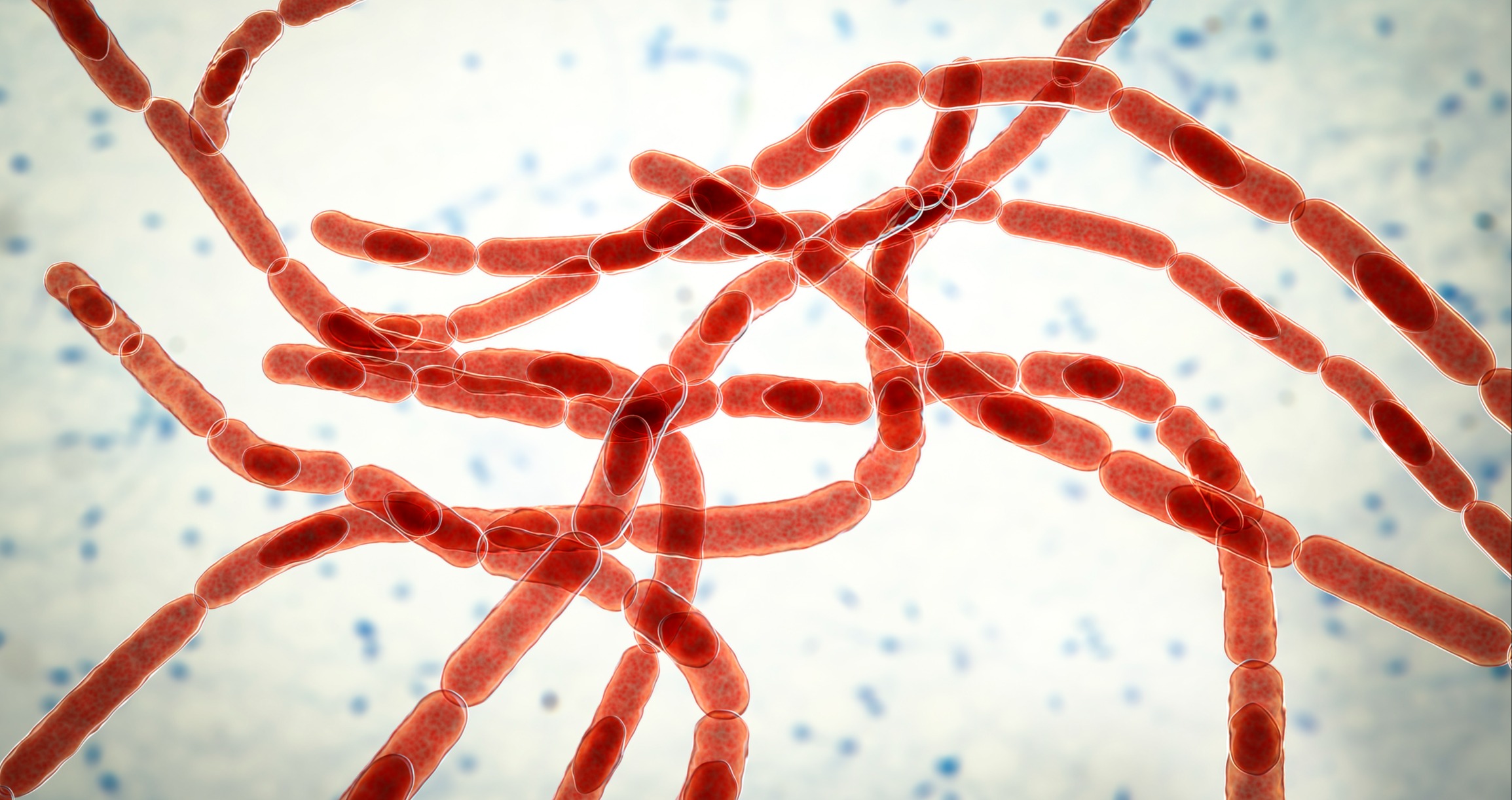 Surprise anthrax case detected in Texas | MDLinx