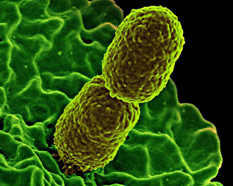 Hypervirulent, hyper-resistant pneumonia superbug kills 5 in China ...