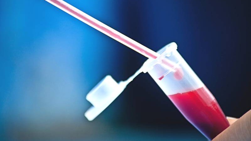 When 'normal' labs lead to abnormal anxiety in your patients: A rant ...