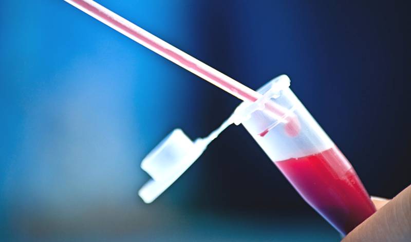 Novel, high-accuracy blood test can screen for multiple cancers | MDLinx