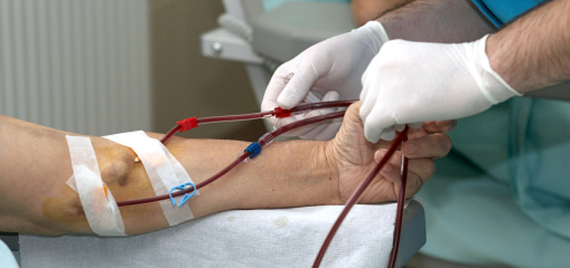 Combo treatment highly effective for patients with HCV and CKD | MDLinx