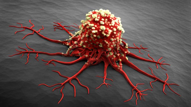 7 things you didn’t know could cause cancer | MDLinx