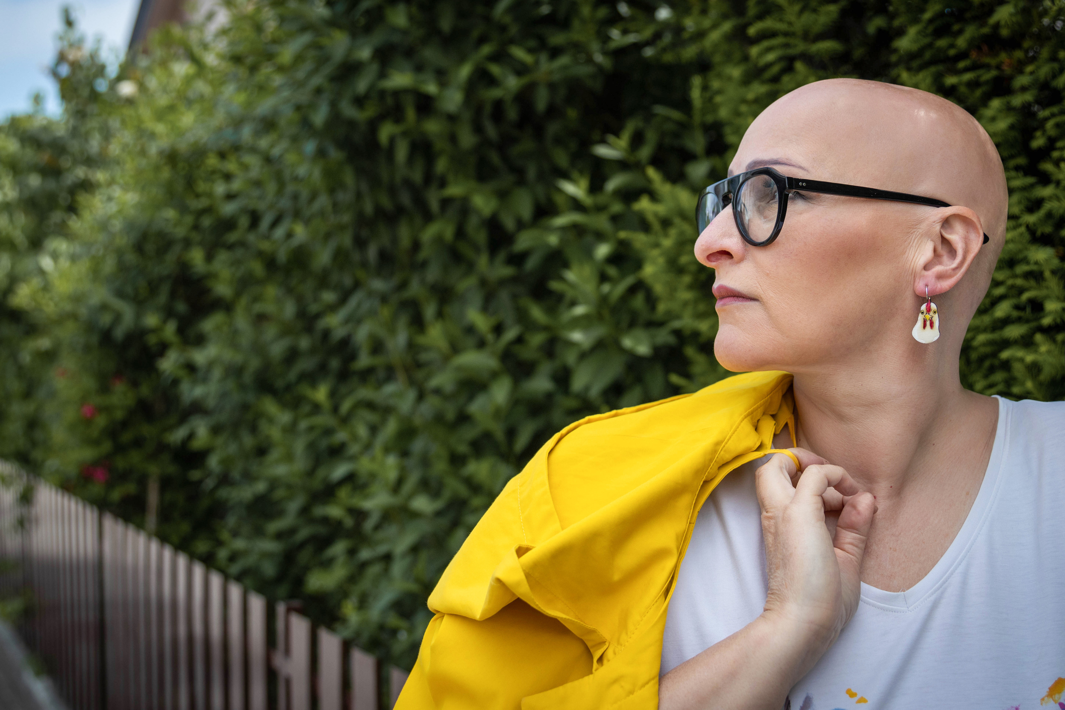 How ‘the slap’ is leading to alopecia awareness | MDLinx